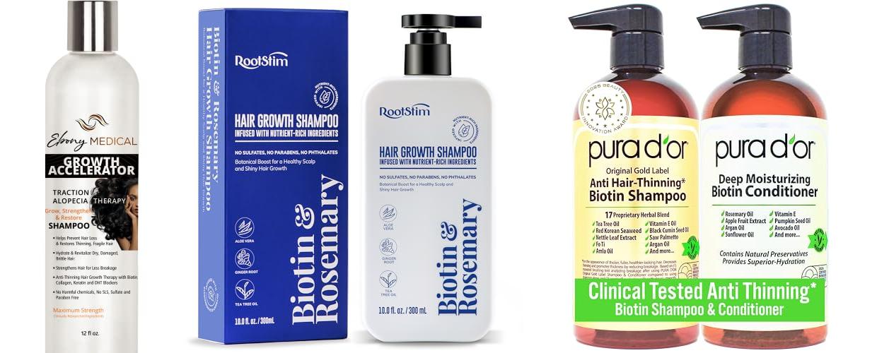 Top 5 Alopecia Areata Shampoos: Your Essential Guide - AnimalsPick